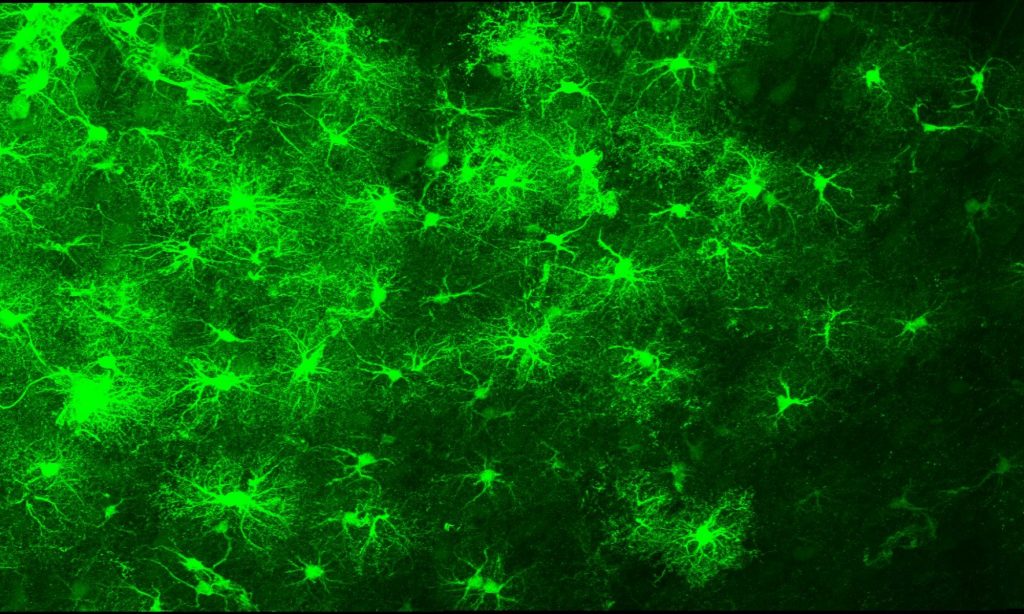 Visualizing Astrocytes – Welcome to the Newman Lab